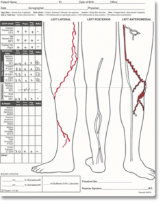 Leg Venous Mapping